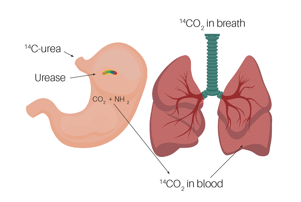 C14-urea breath test | Sonic Bookings